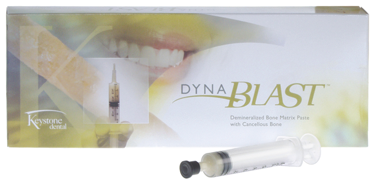DynaBlast Paste – Salvin Dental Specialties