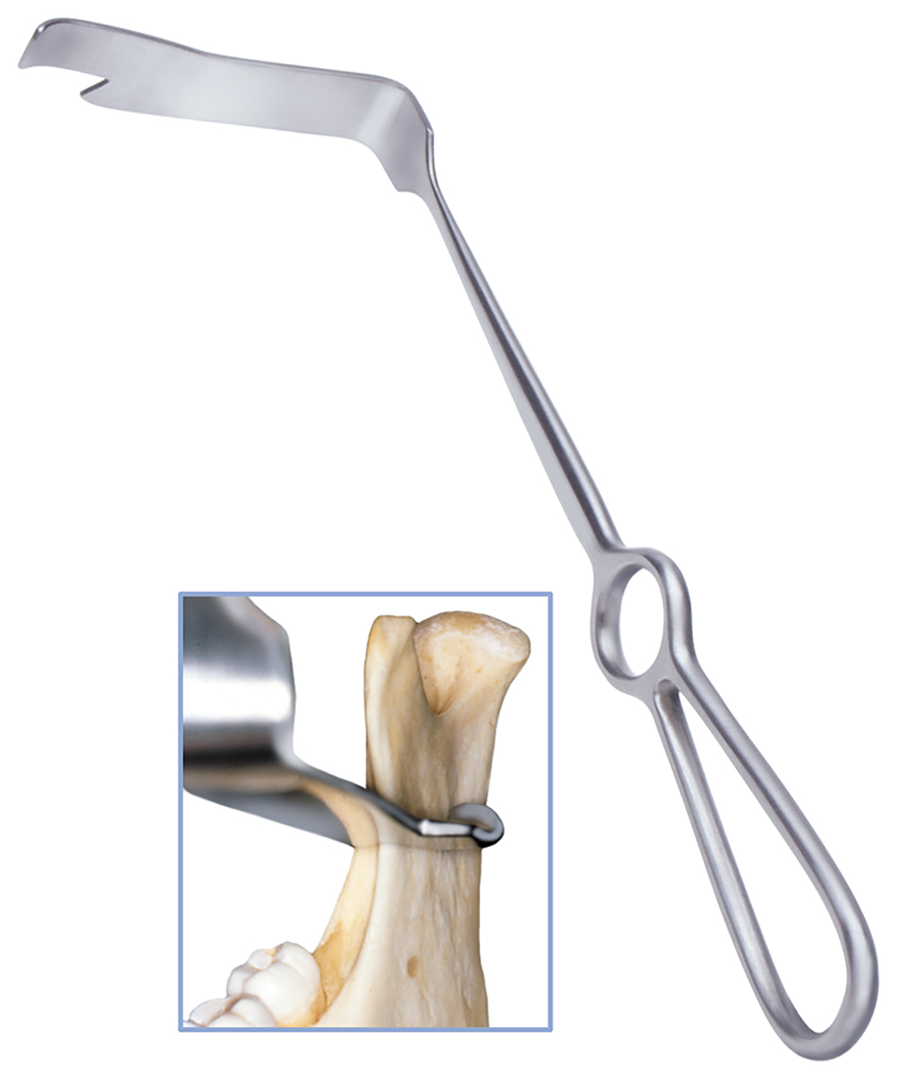 Salvin Misch Ramus Retractor – Left – Salvin Dental Specialties