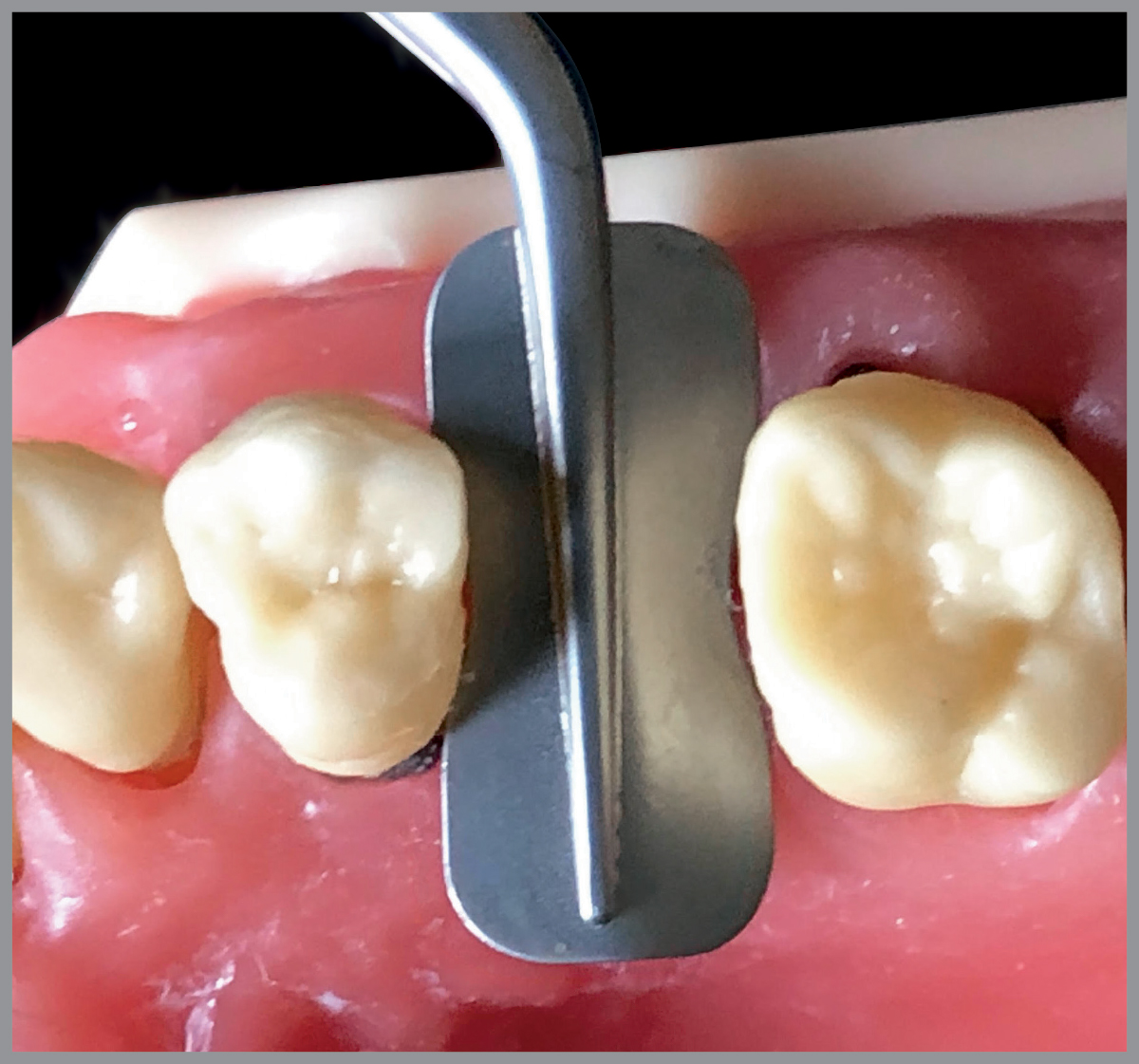 Salvin Membrane / PRF Forceps With “Peanut” Shaped Tip – Right – Salvin ...